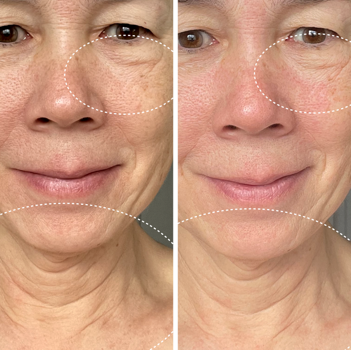 Droplette - Skincare On A Deeper Level